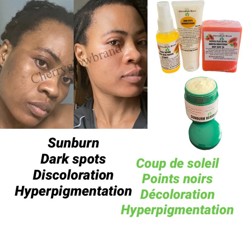 Facial Set for Discoloration and Hyperpigmentation (4 Products; with ...