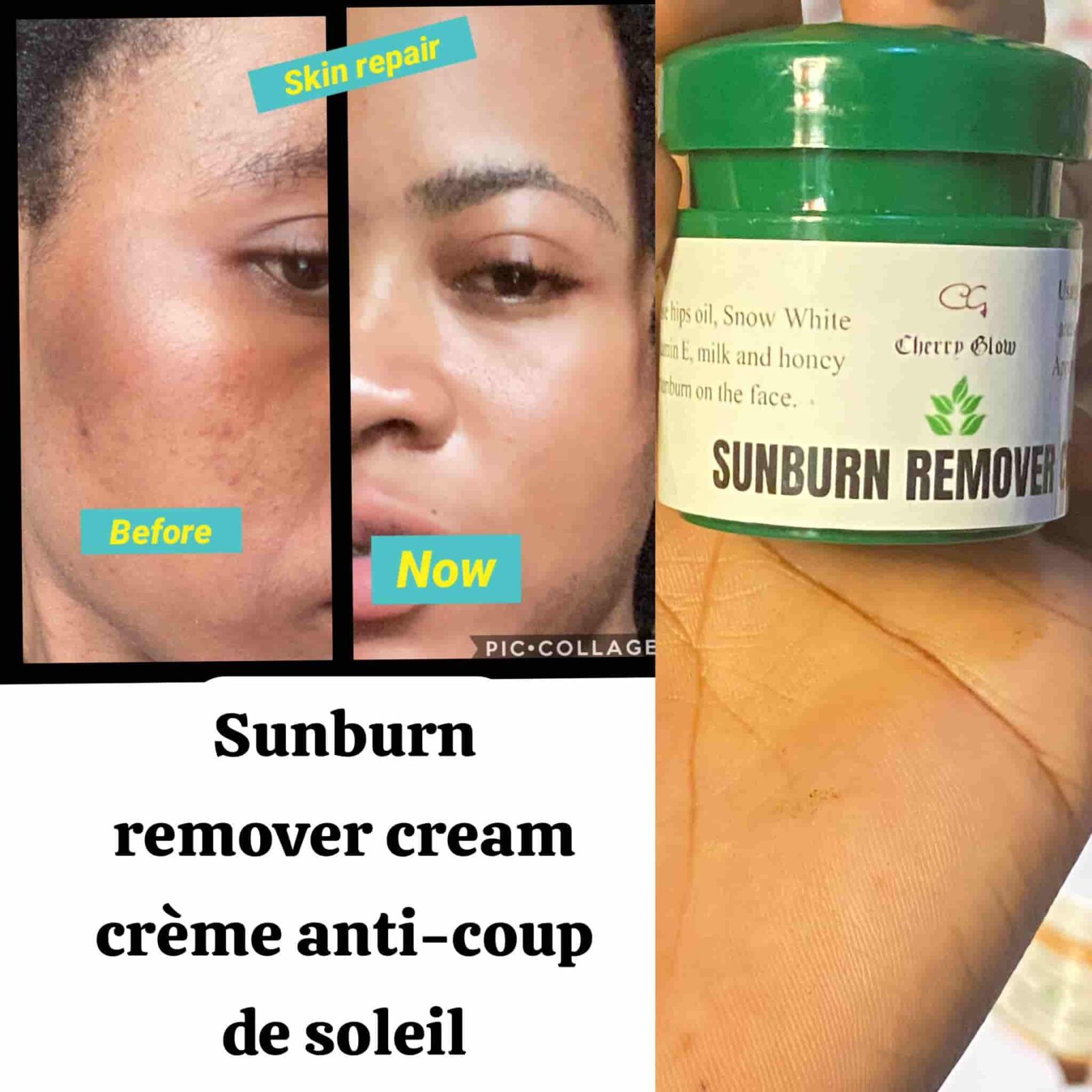 Sunburn Remover Cream 15g x2 – CherryGlowBrand