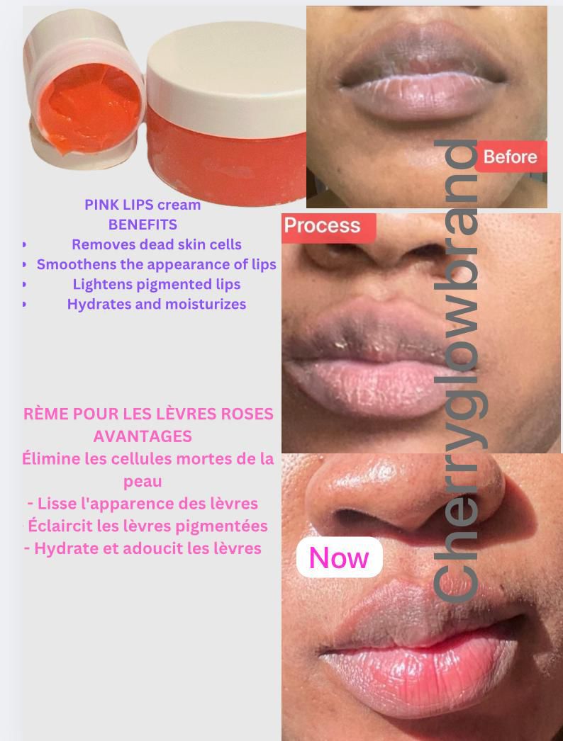 Pink Lips Kit – CherryGlowBrand